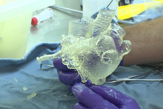 UW Medicine, VA partner on 3D-print models for heart care - UW Medicine ...